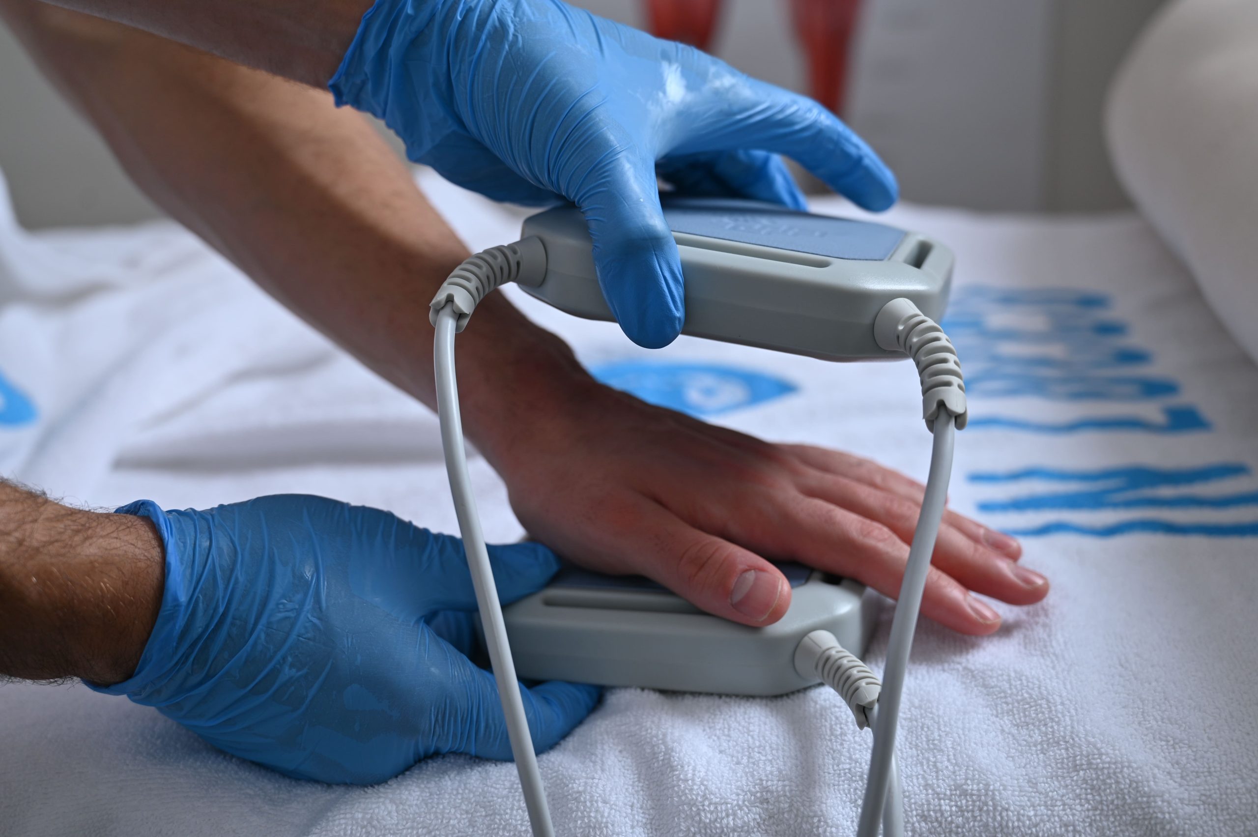 Bol u Prstima na Rukama - Fizio Centar In Locco